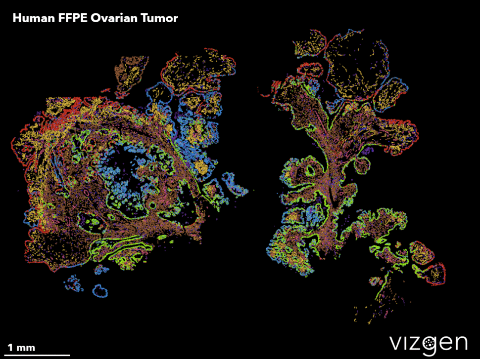 The Road From Spatial Mapping Of Cells To Improved Human Health Vizgen
