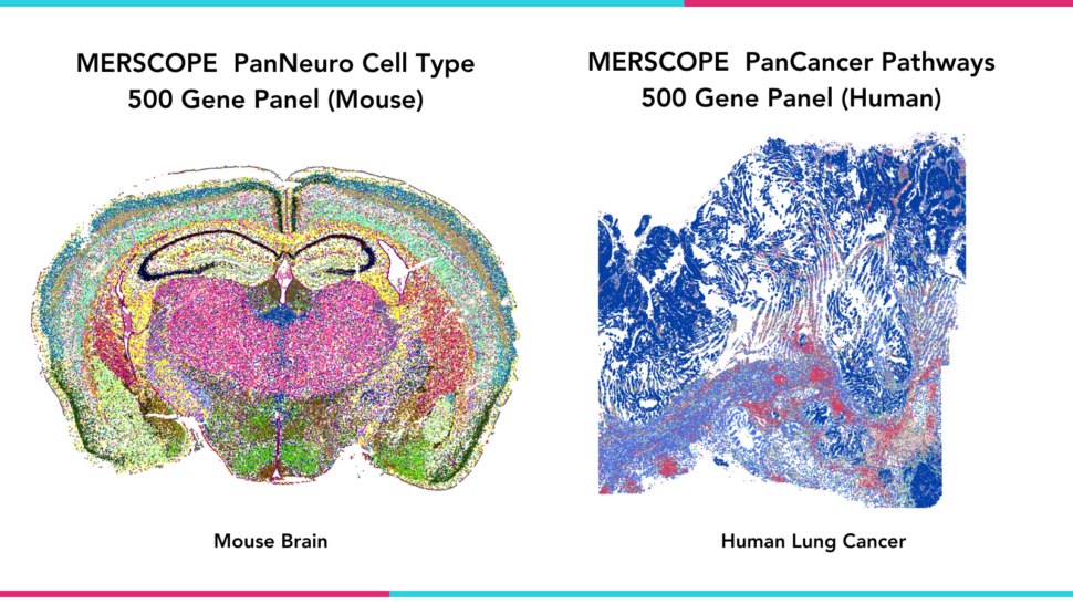 Developing Spatial Transcriptomics Data Analysis Solutions to Empower ... Developing Spatial Transcriptomics Data Analysis Solutions to Empower ...