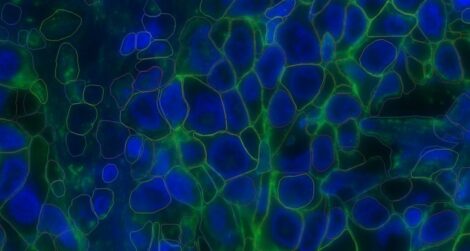 Developing Spatial Transcriptomics Data Analysis Solutions to Empower ...