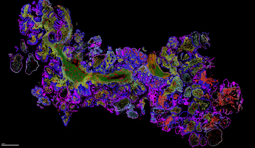 Tissue Architecture Exploration with MERSCOPE | Vizgen